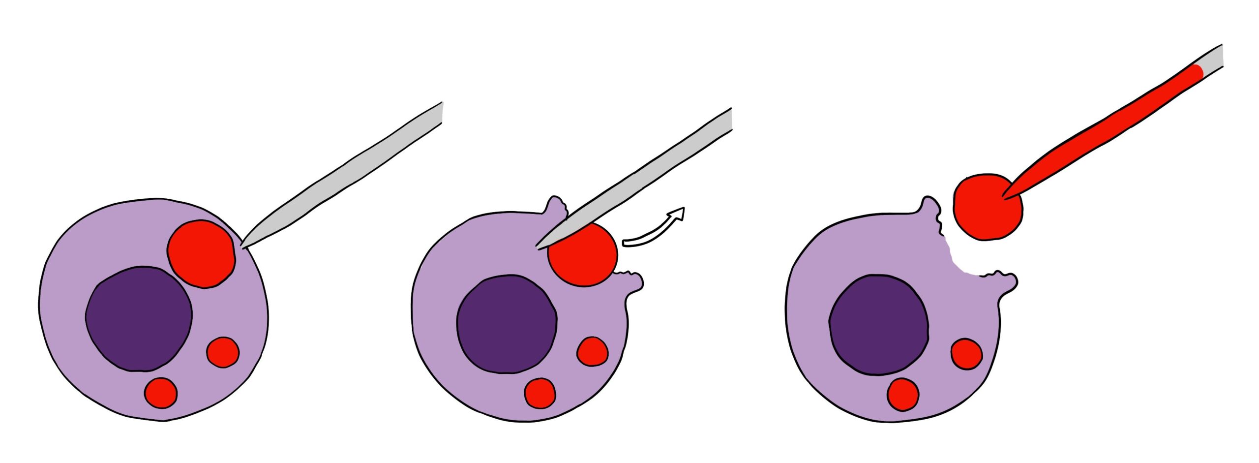 Endo-lysosomal patch clamp assay